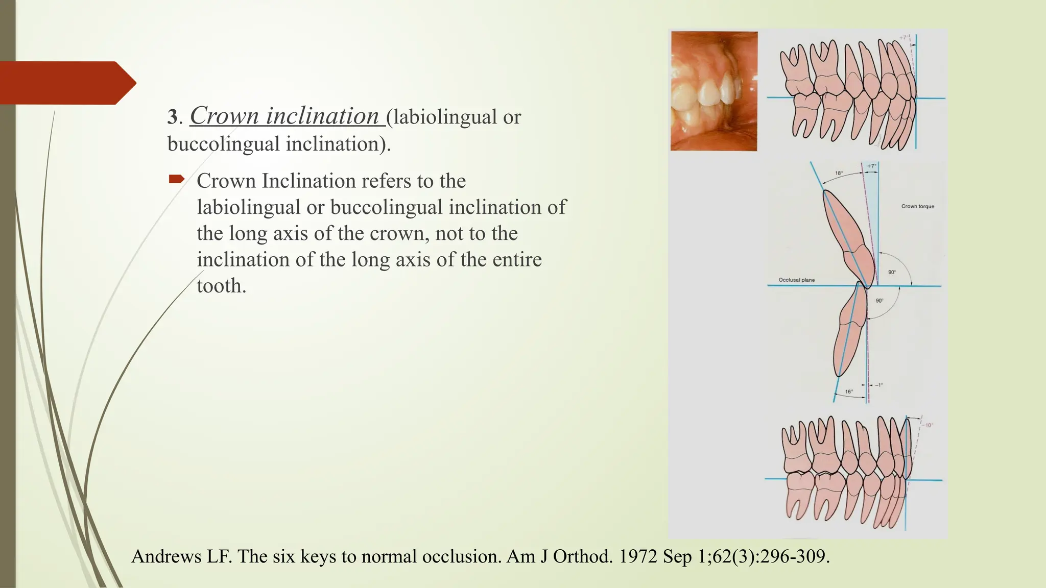 CLASSIFICATION OF MALOCCLUSION in orthodontics | PPTX
