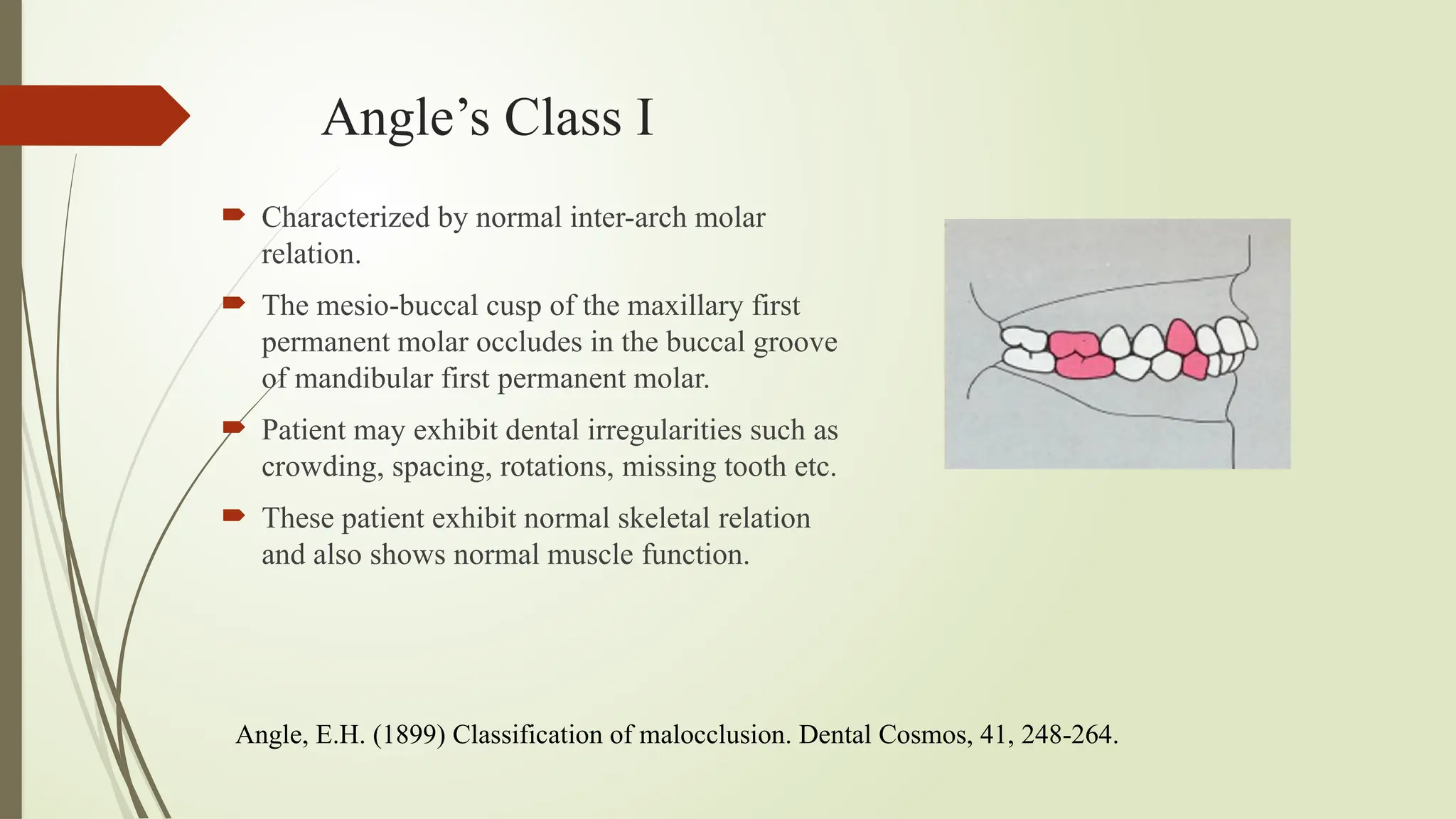CLASSIFICATION OF MALOCCLUSION in orthodontics | PPTX