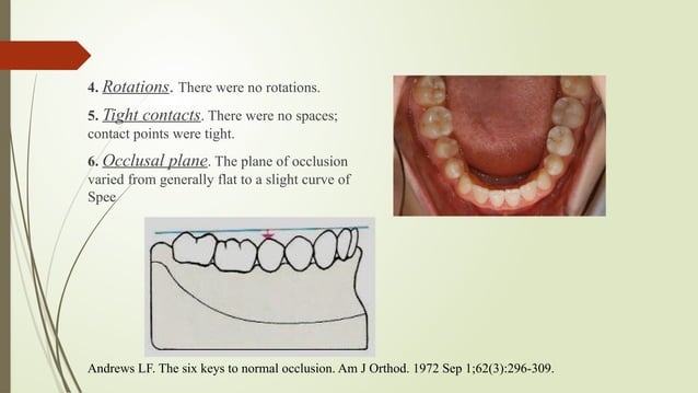 CLASSIFICATION OF MALOCCLUSION in orthodontics | PPTX