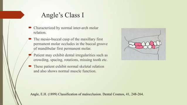 CLASSIFICATION OF MALOCCLUSION in orthodontics | PPTX