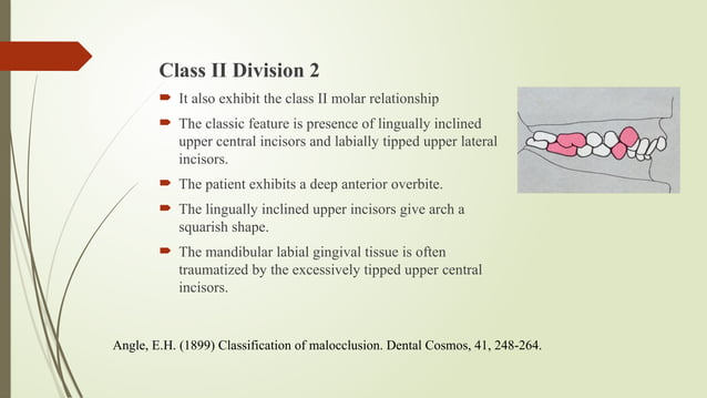 CLASSIFICATION OF MALOCCLUSION in orthodontics | PPTX