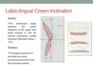 Classification of Maloccvbvvbblusion.pptx
