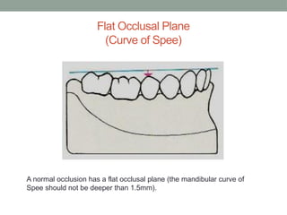 Classification of Maloccvbvvbblusion.pptx