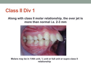 Classification of Maloccvbvvbblusion.pptx