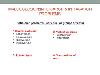 Classification of Maloccvbvvbblusion.pptx