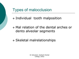 CLASSIFICATION OF MALOCCLUSION IN ORTHODONTICS | PDF