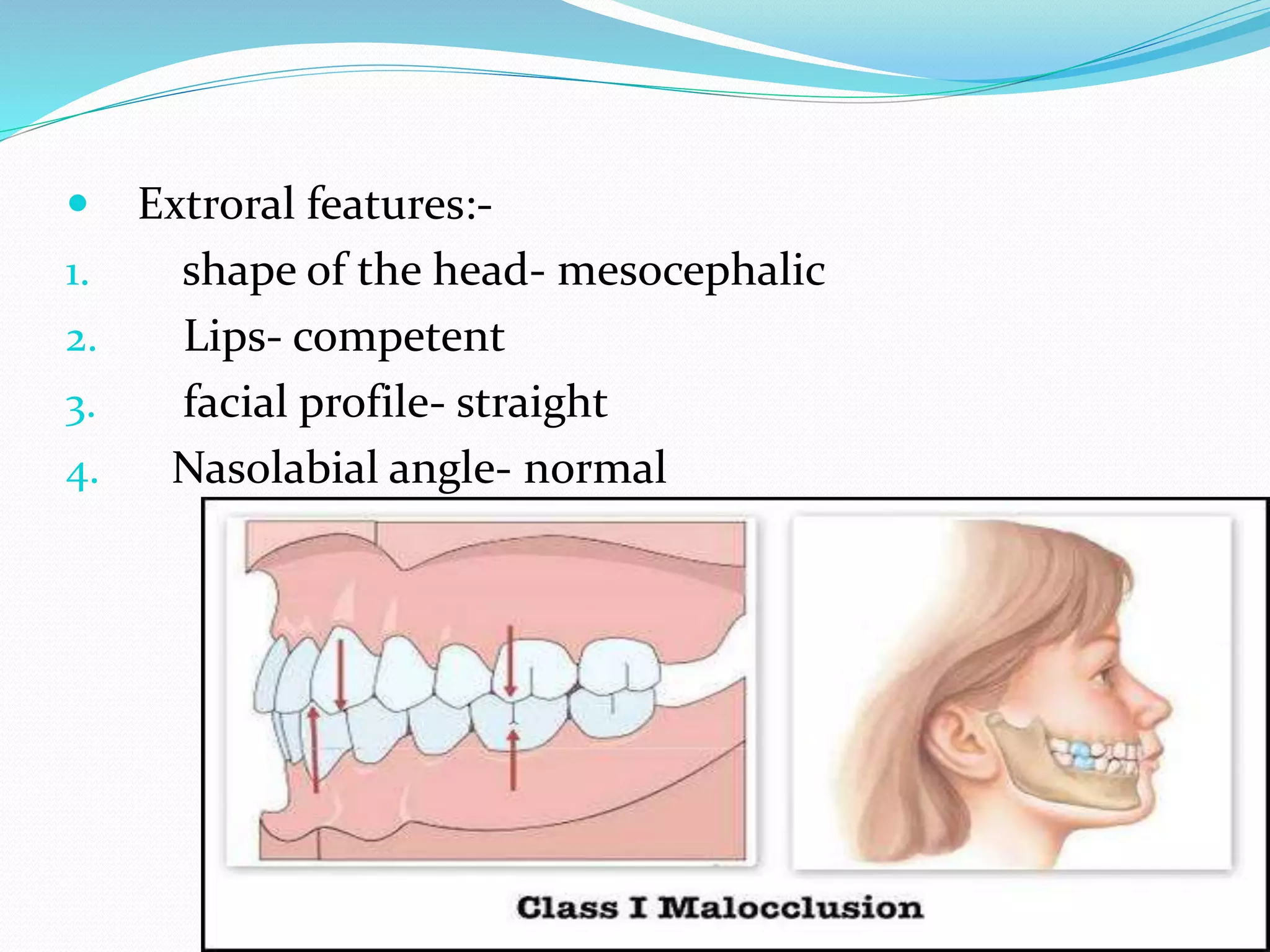 Classification of malocclusion | PPTX