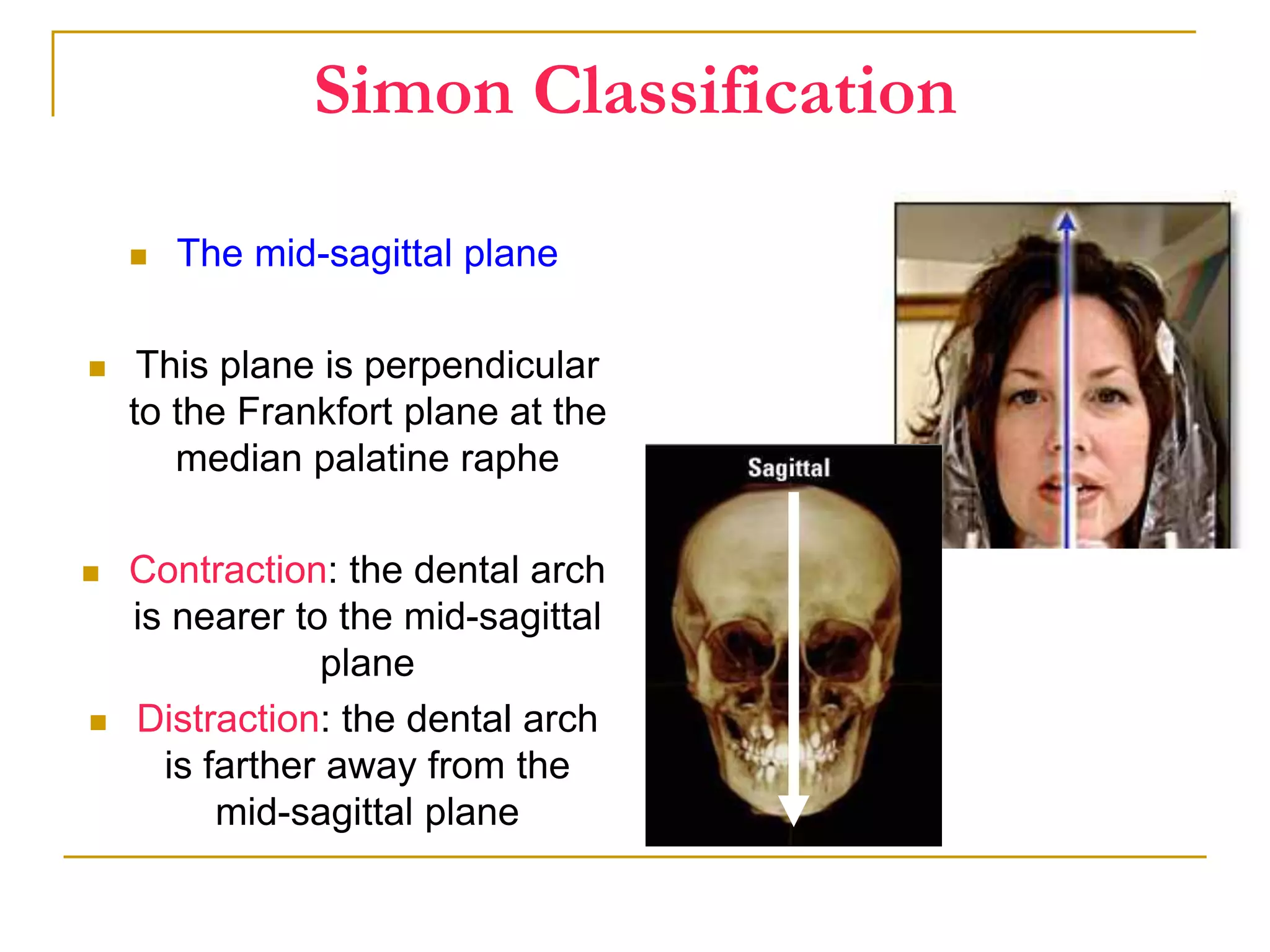 Classification of malocclusion-converted (1).pdf