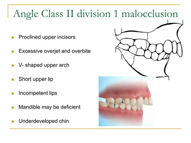 Classification of malocclusion-converted (1).pdf
