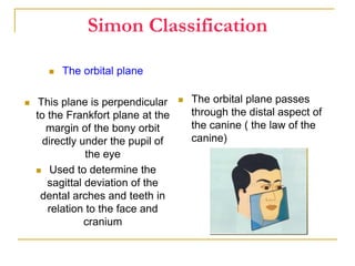 Classification of malocclusion-converted (1).pdf