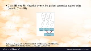 Classification of Malocclusion is a new presentation | PPTX