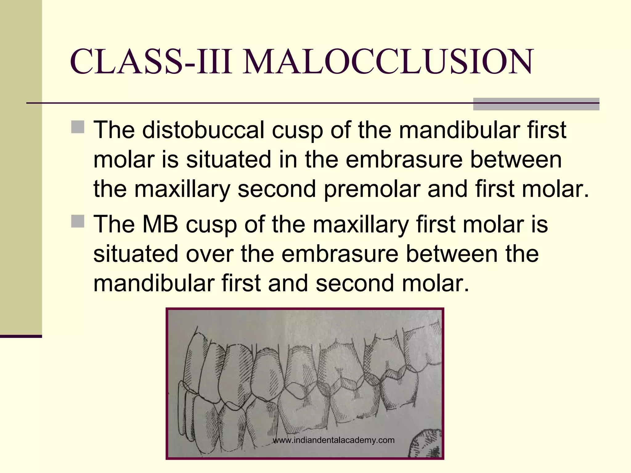 Classification of malocclusion | PPT