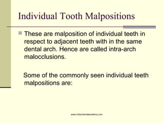 Classification of malocclusion | PPT