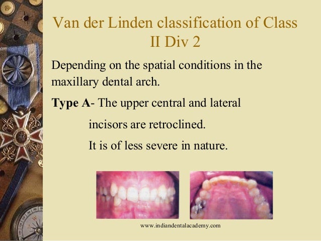Classification of malocclusion1