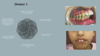 Classification_of_malocclusion[1] [Read-Only].pptx