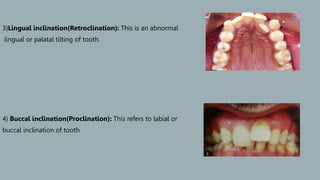 Classification_of_malocclusion[1] [Read-Only].pptx