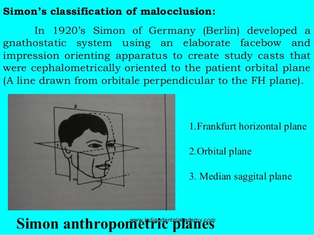 Classification of malocclusion (4)