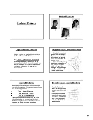 Classification of malocclusion gallois 06 final bw | PDF