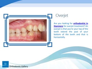 Classification of Malocclusion in Orthodontics | PPT