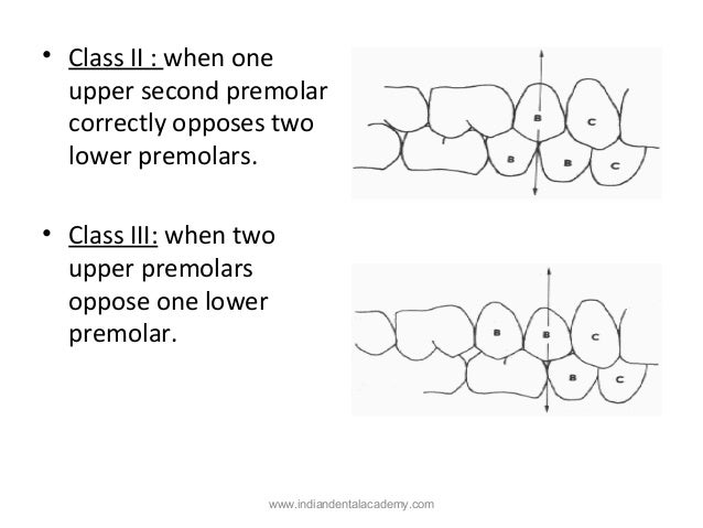 Classification of malocclusion /certified fixed orthodontic courses