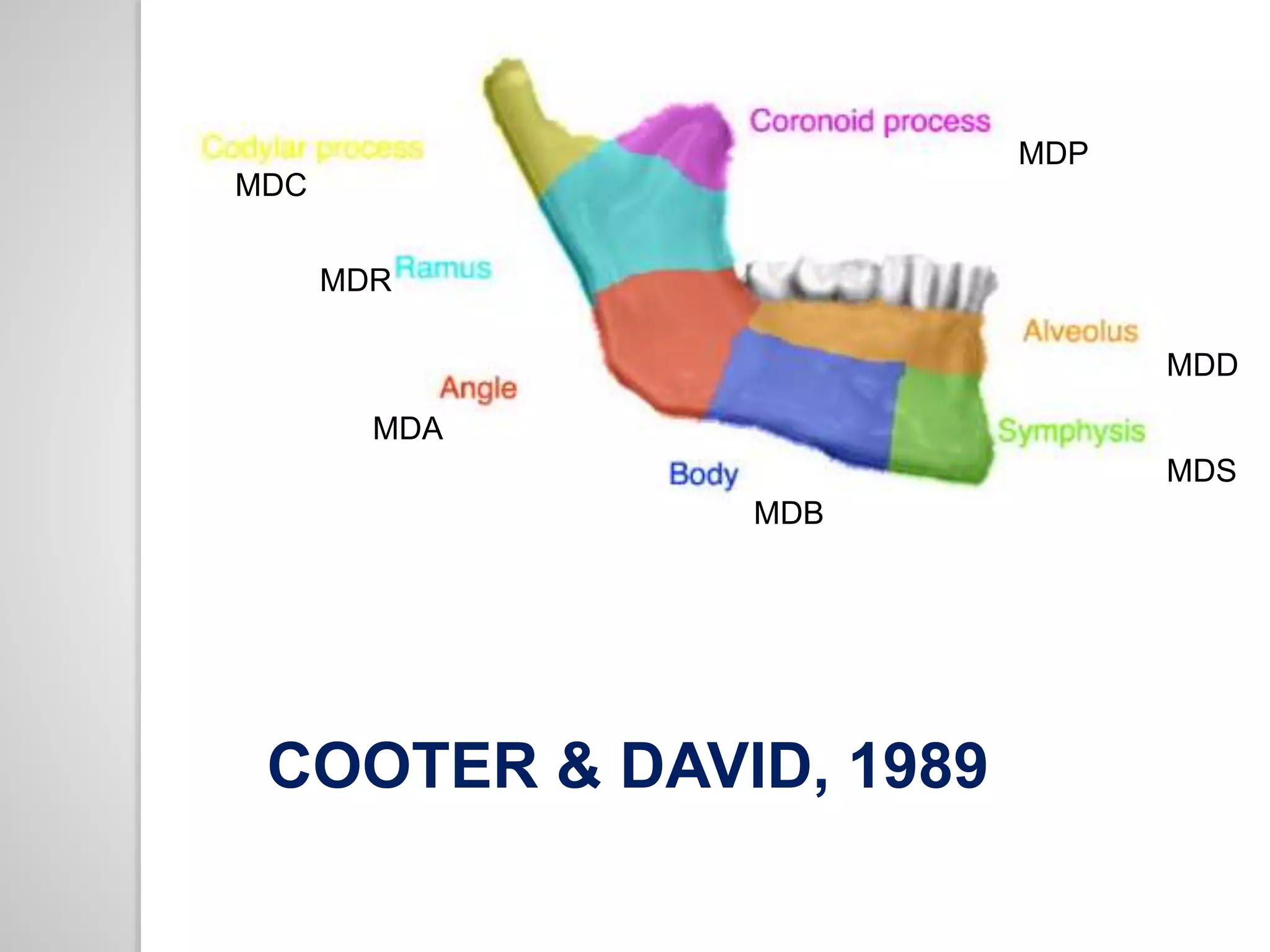 Classification of mandible fracture | PPTX