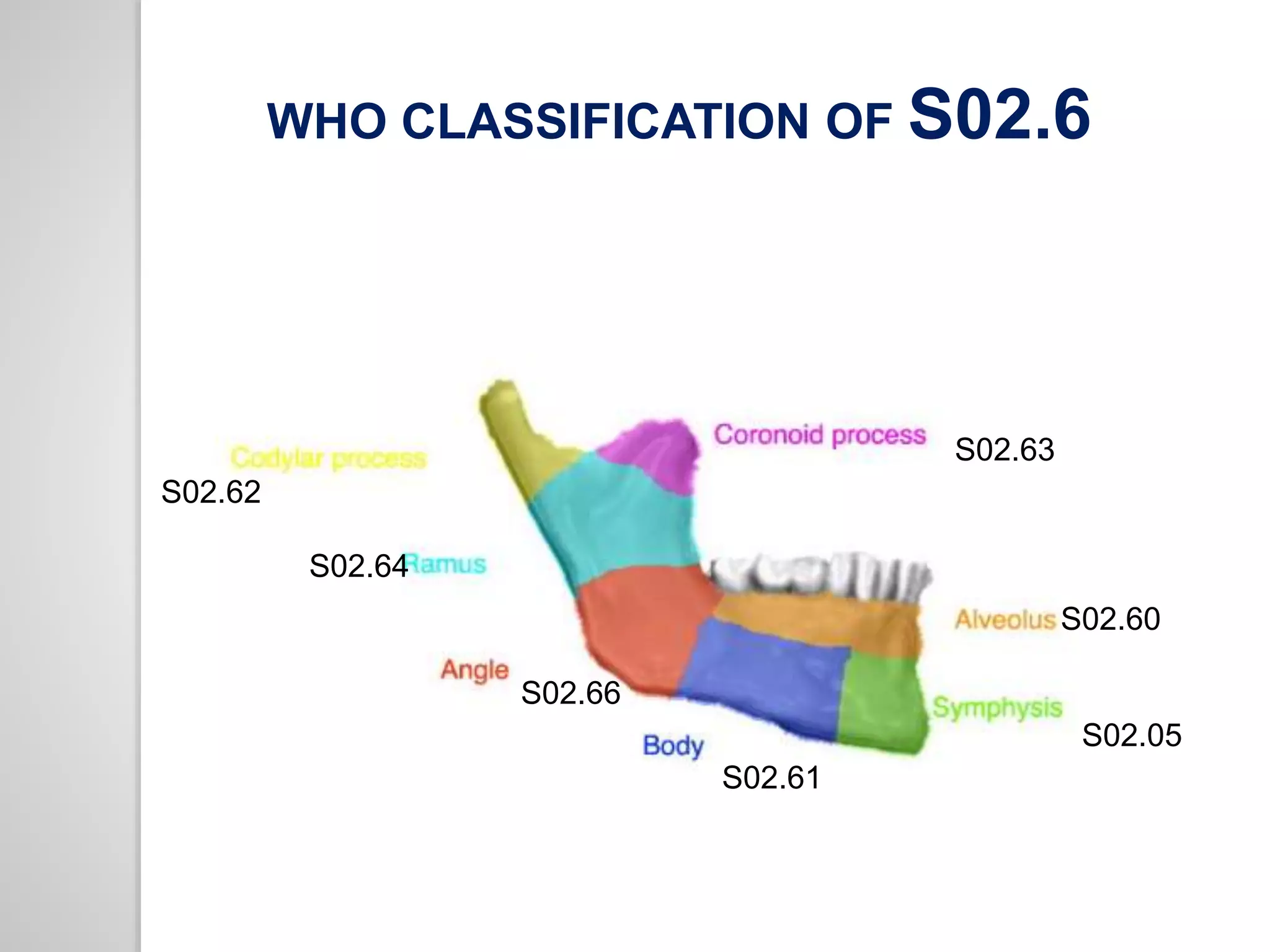 Classification of mandible fracture | PPTX