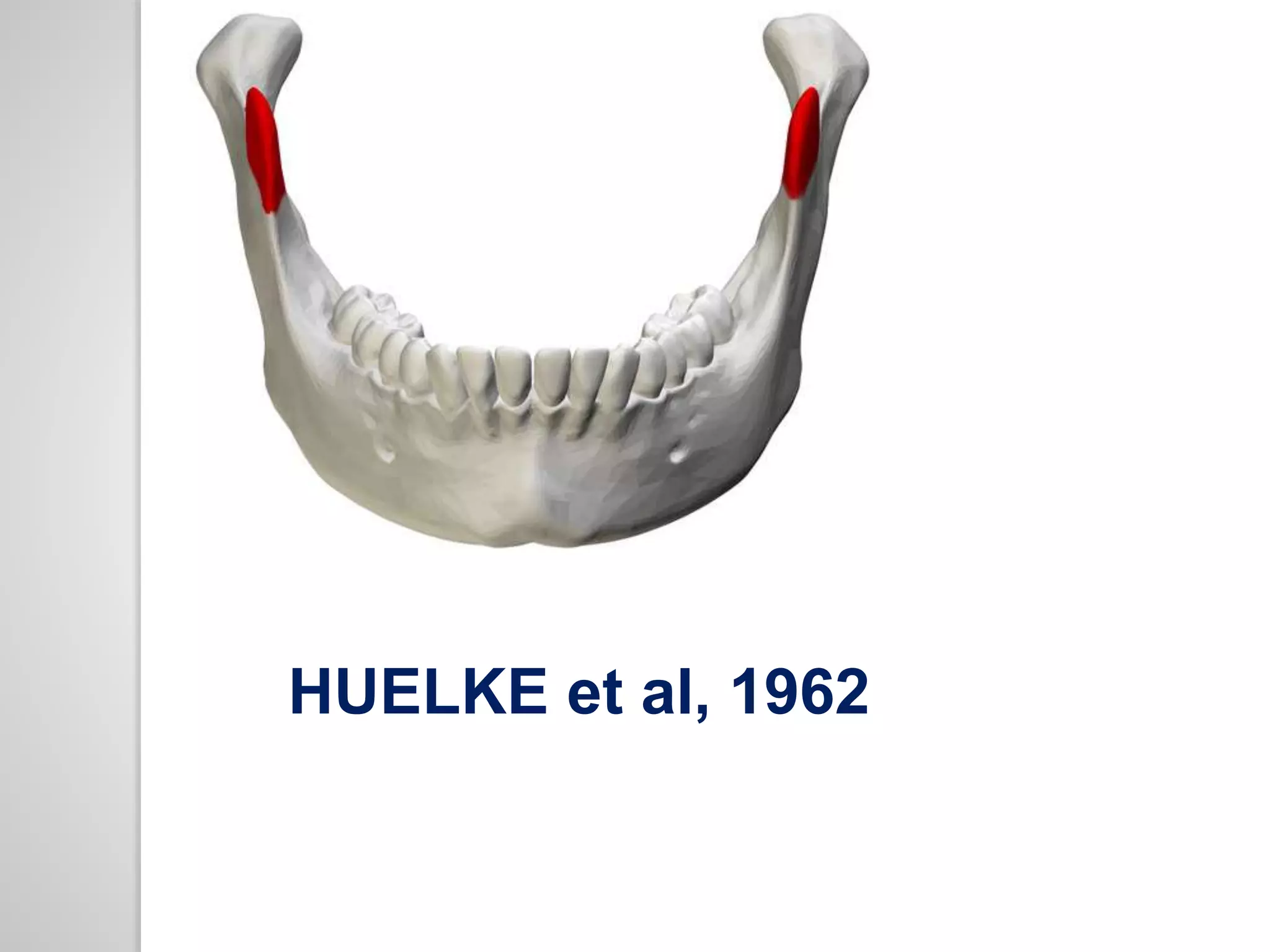 Classification of mandible fracture | PPTX