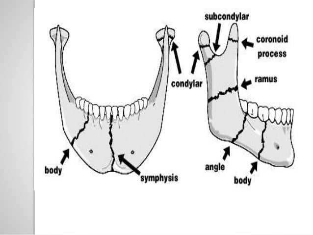 Classification of mandible fracture