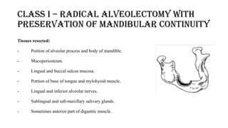 CLASSIFICATION OF MANDIBULAR DEFECTS.pptx