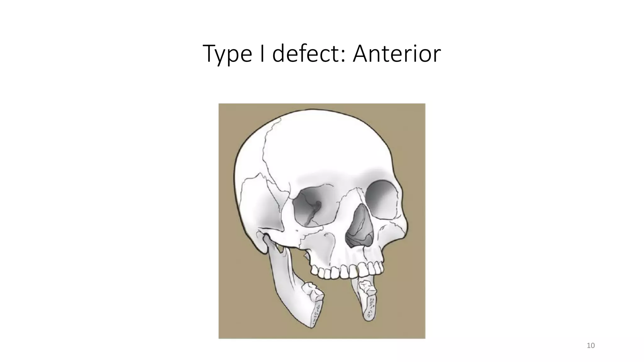 Classification of mandibular defects | PDF