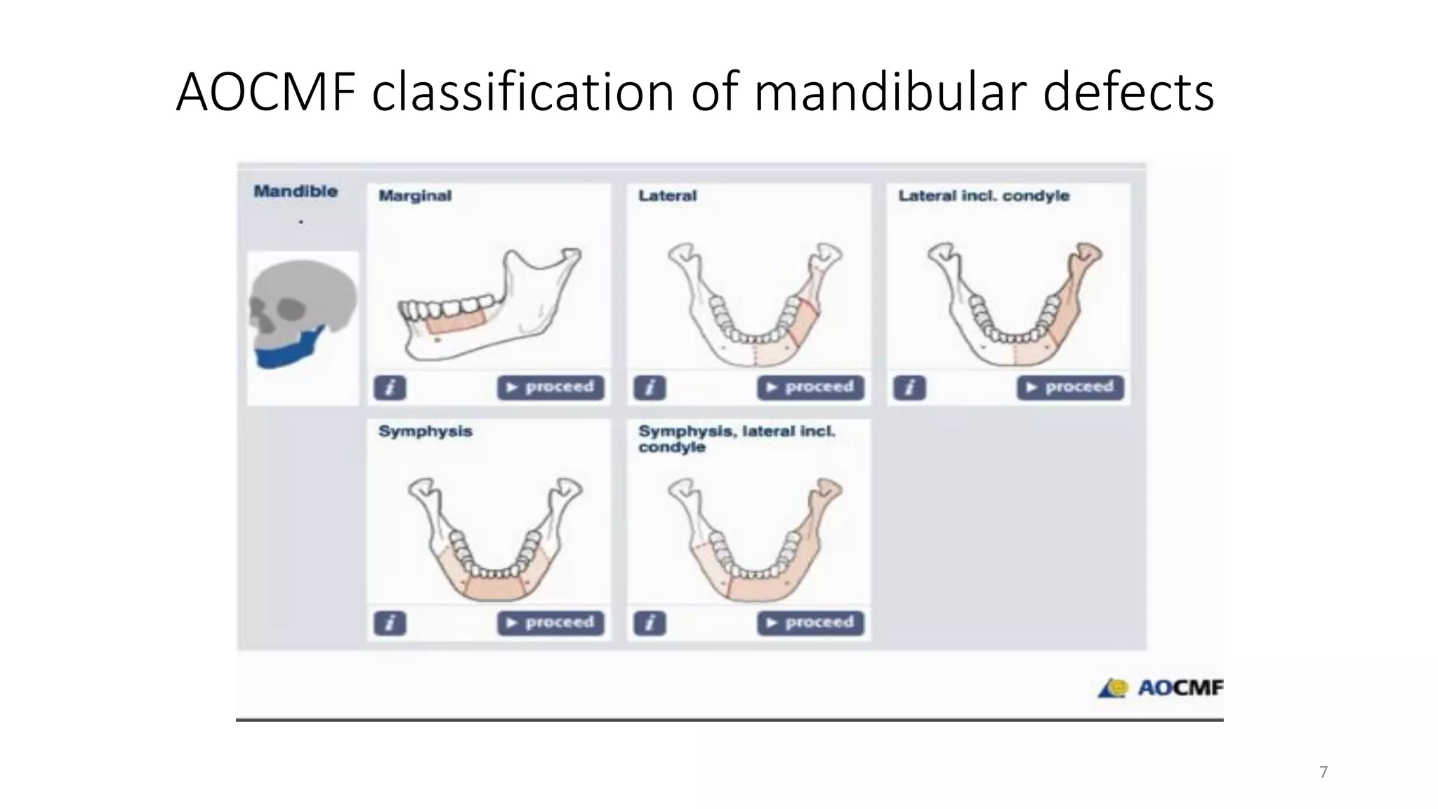 Classification of mandibular defects | PDF