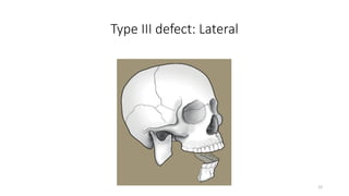 Classification of mandibular defects | PDF