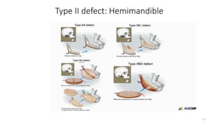 Classification of mandibular defects | PDF