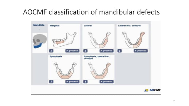 Classification of mandibular defects | PDF | Bone and Joint Conditions ...