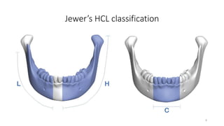 Classification of mandibular defects | PDF