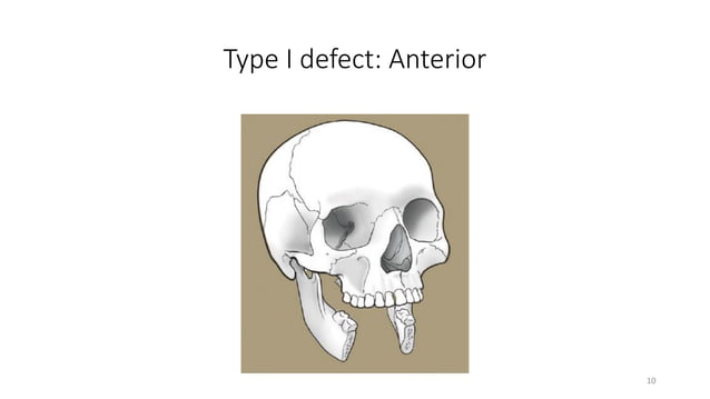 Classification of mandibular defects
