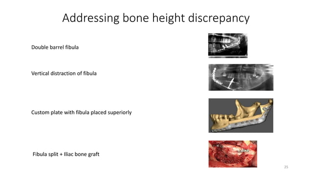 Classification Of Mandibular Defects