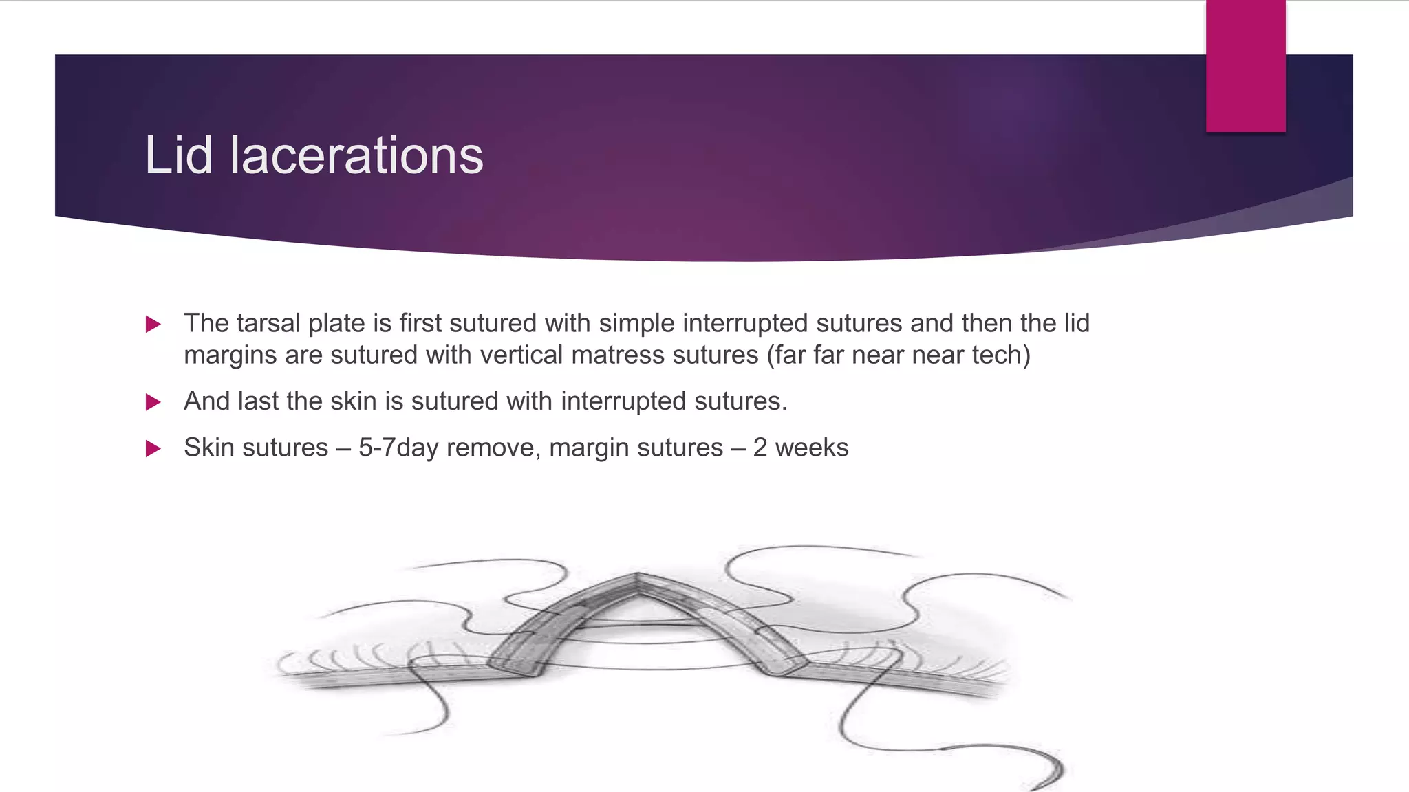 OCULAR TRAUMA - Classification of mechanical injuries, clinical ...