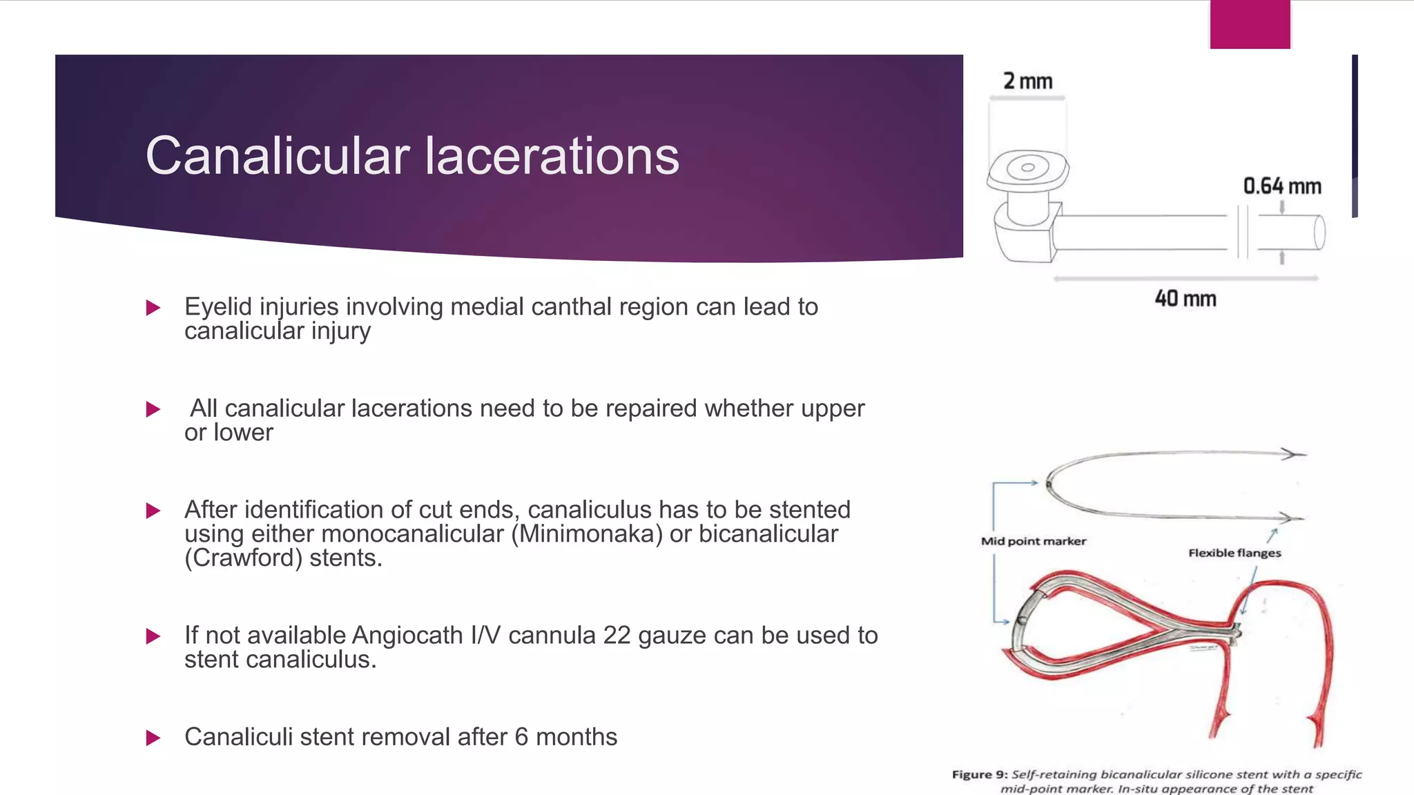OCULAR TRAUMA - Classification of mechanical injuries, clinical ...