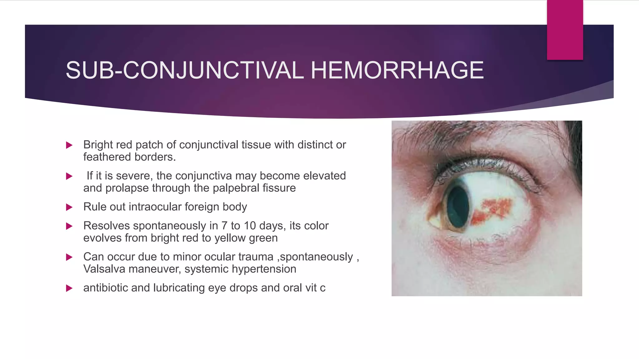 OCULAR TRAUMA - Classification of mechanical injuries, clinical ...