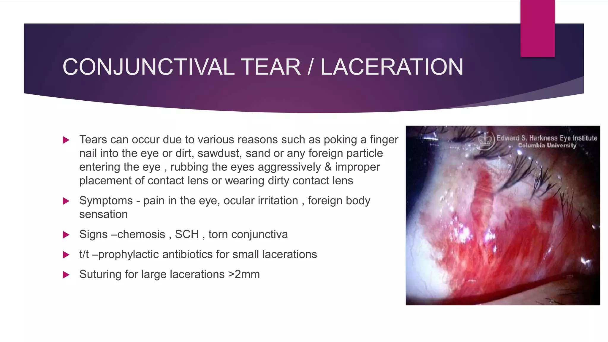 OCULAR TRAUMA - Classification of mechanical injuries, clinical ...