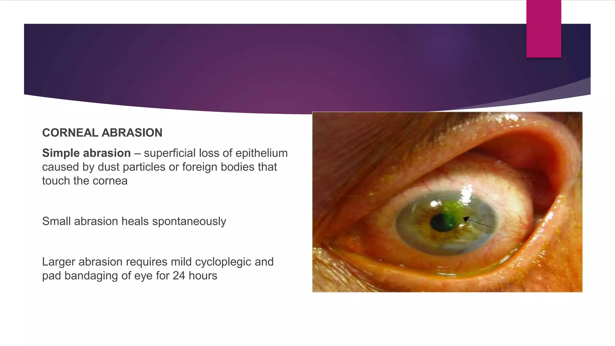 OCULAR TRAUMA - Classification of mechanical injuries, clinical ...