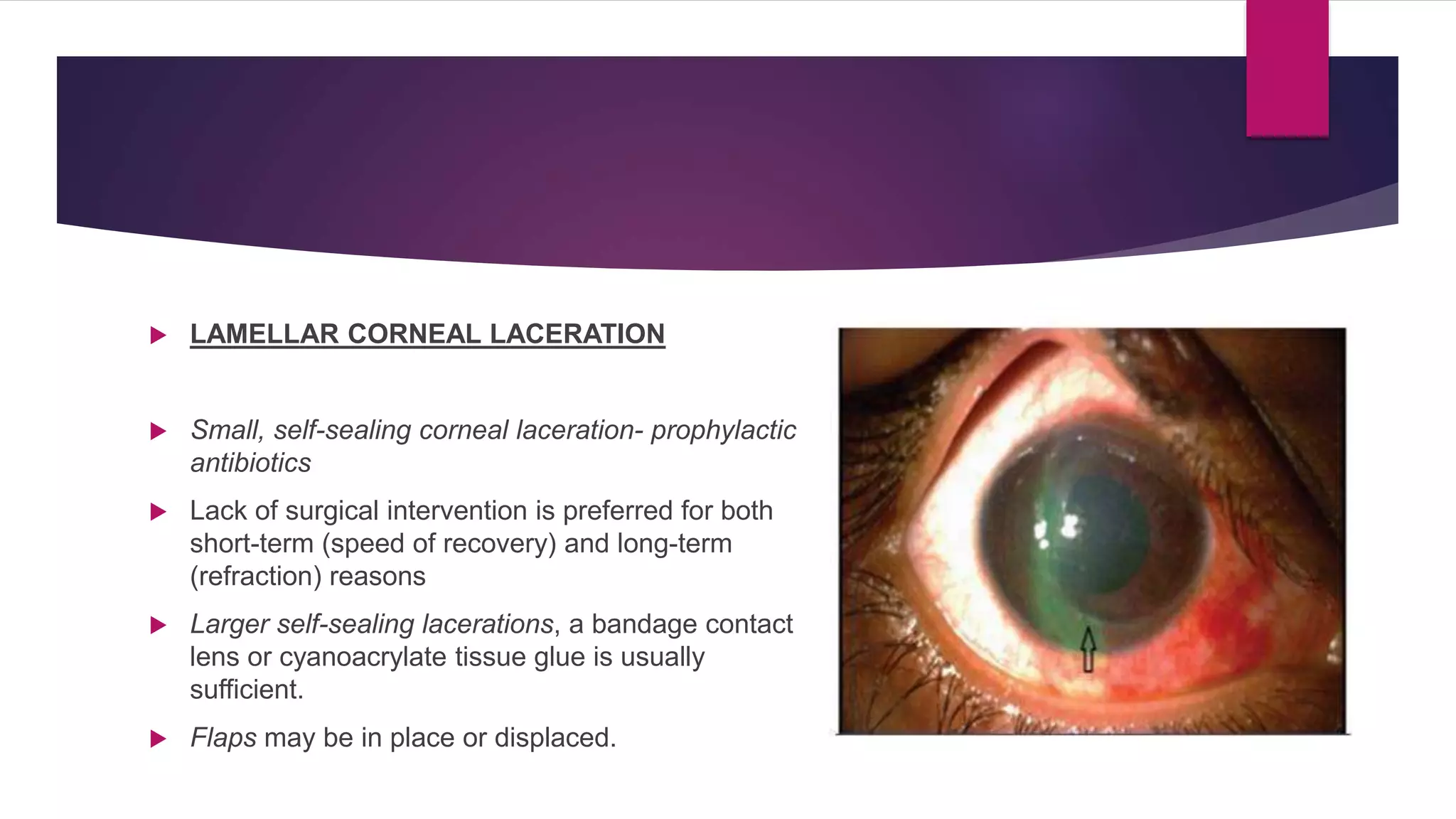 OCULAR TRAUMA - Classification of mechanical injuries, clinical ...