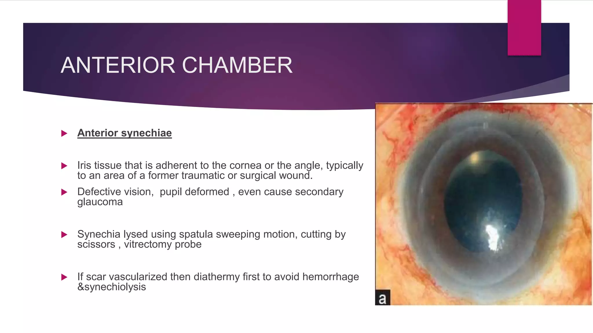 OCULAR TRAUMA - Classification of mechanical injuries, clinical ...
