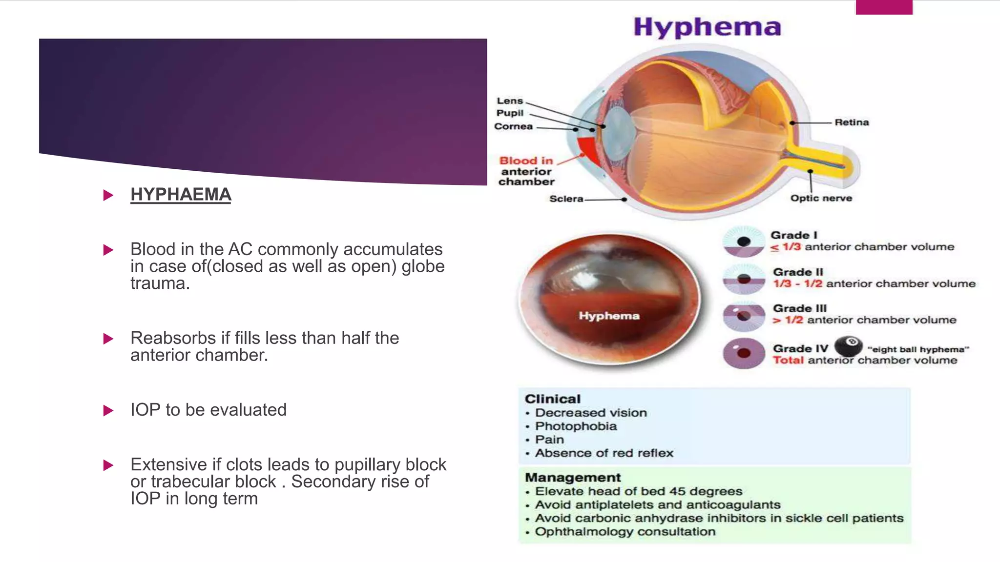 OCULAR TRAUMA - Classification of mechanical injuries, clinical ...