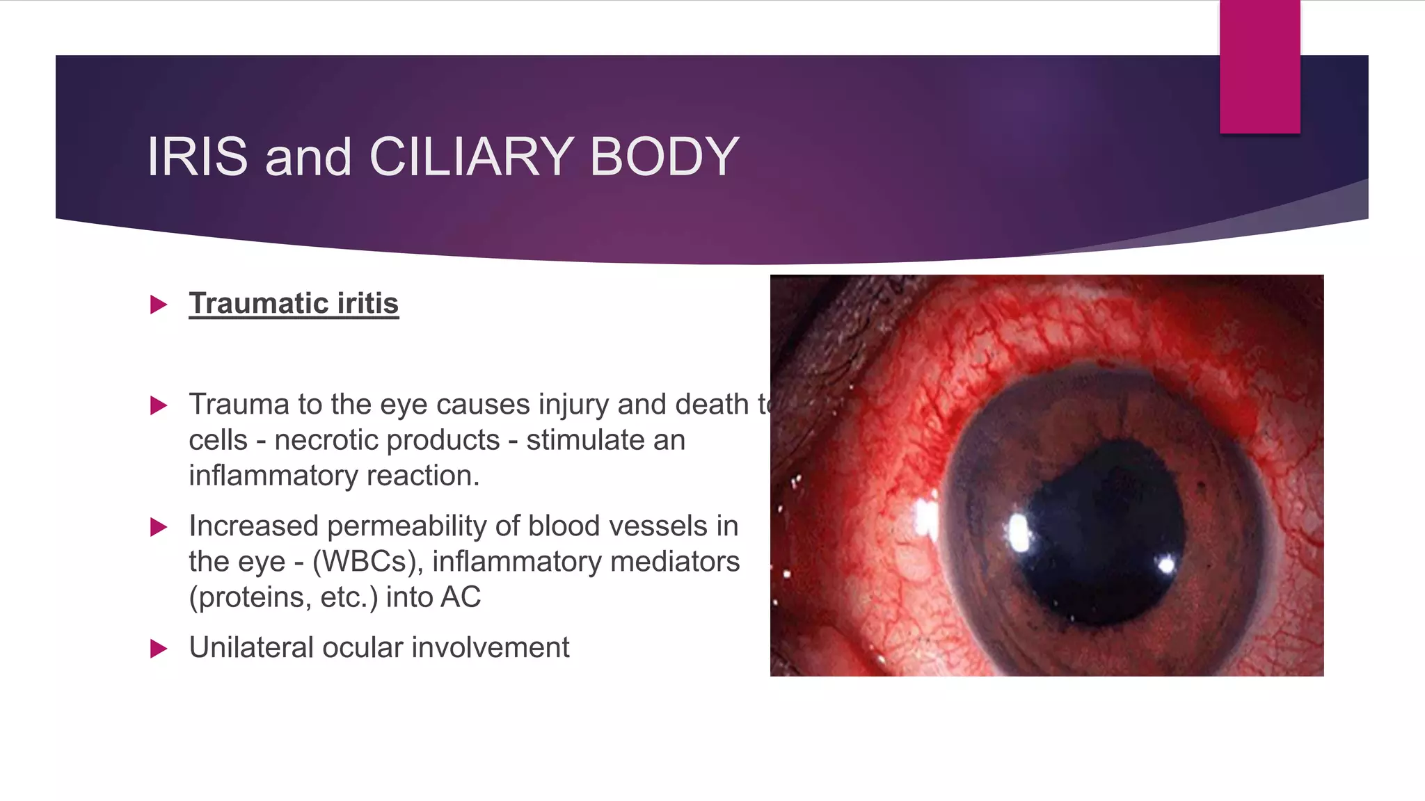 OCULAR TRAUMA - Classification of mechanical injuries, clinical ...