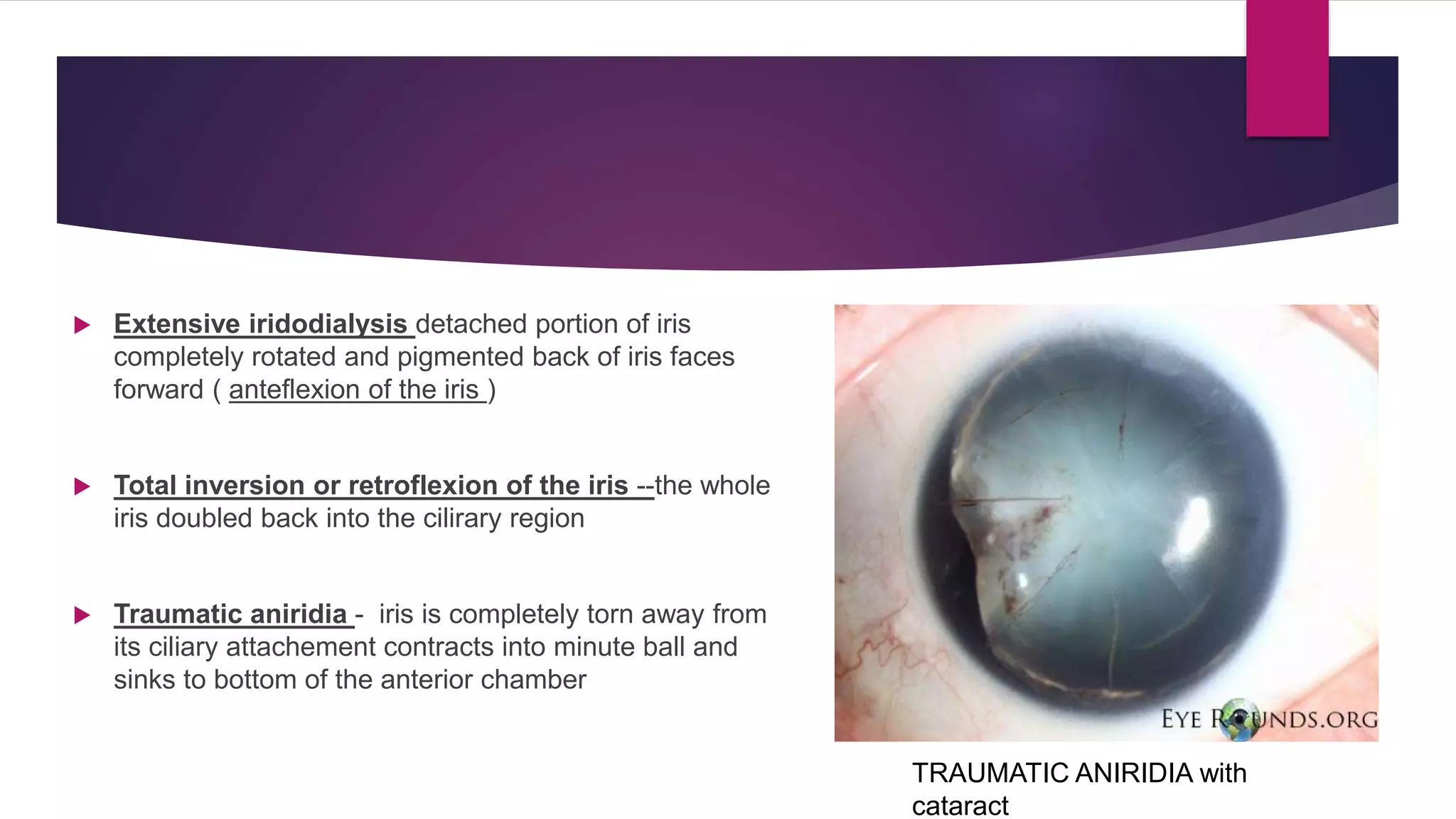 OCULAR TRAUMA - Classification of mechanical injuries, clinical ...