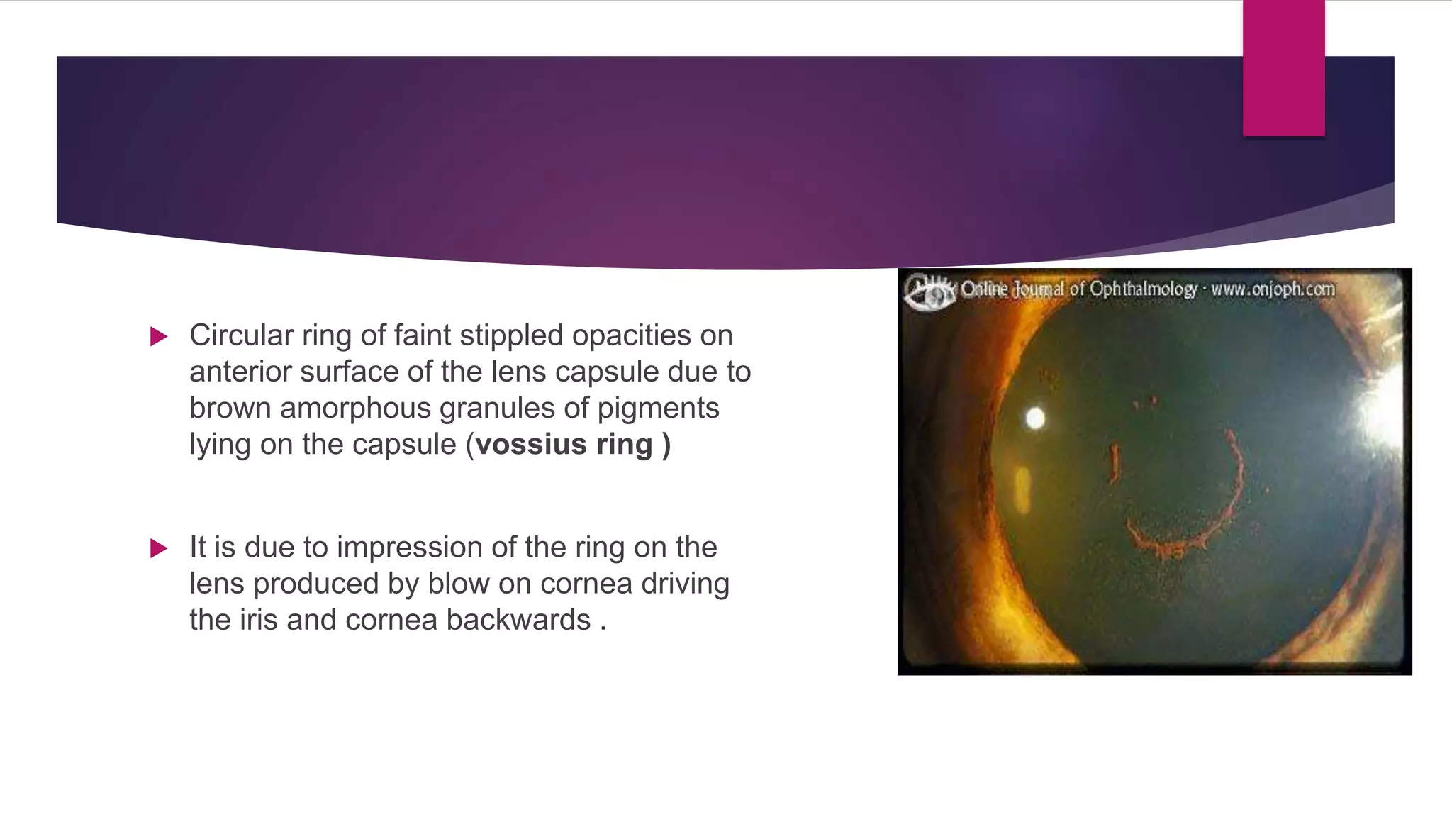 OCULAR TRAUMA - Classification of mechanical injuries, clinical ...