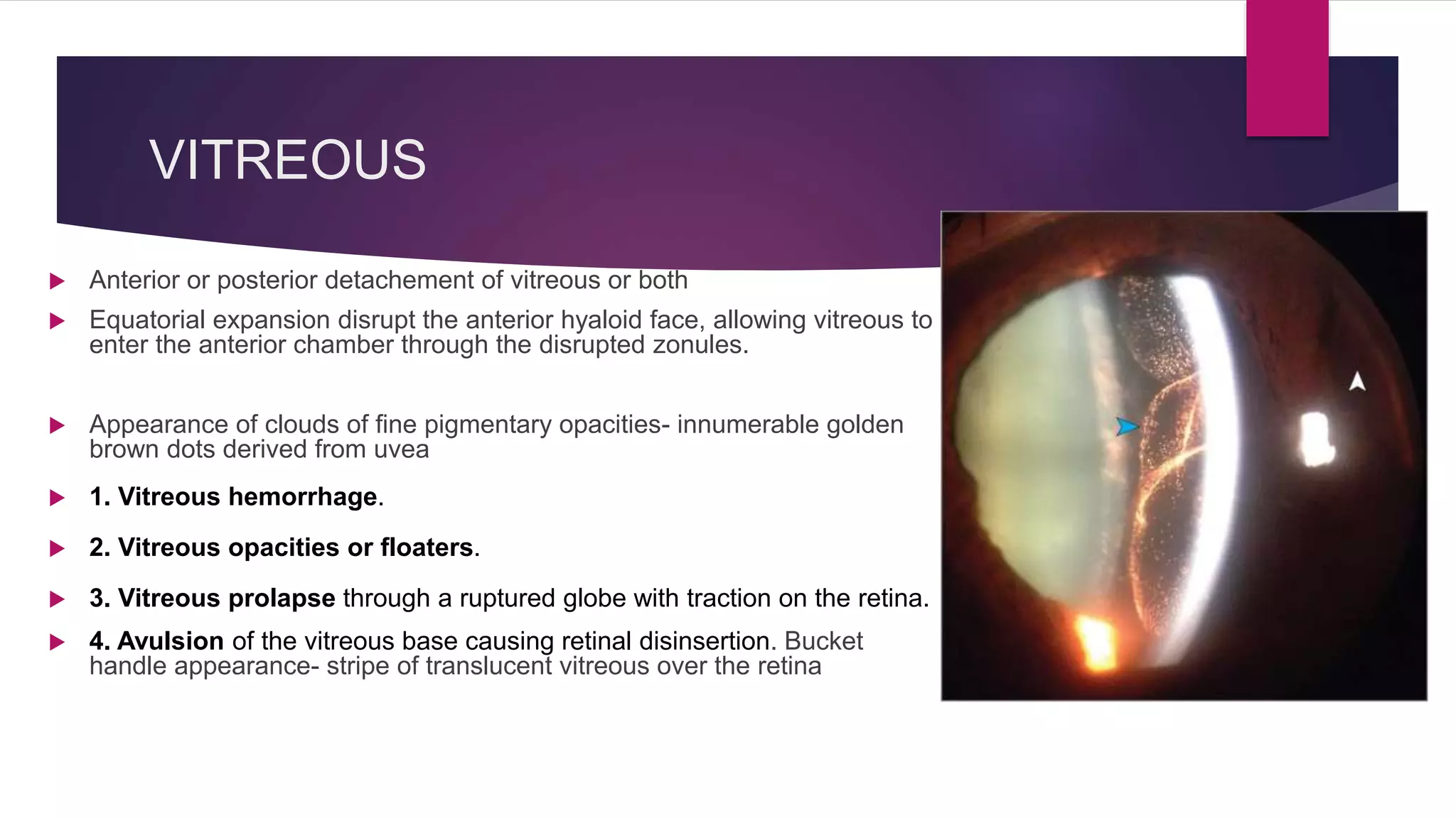 OCULAR TRAUMA - Classification of mechanical injuries, clinical ...