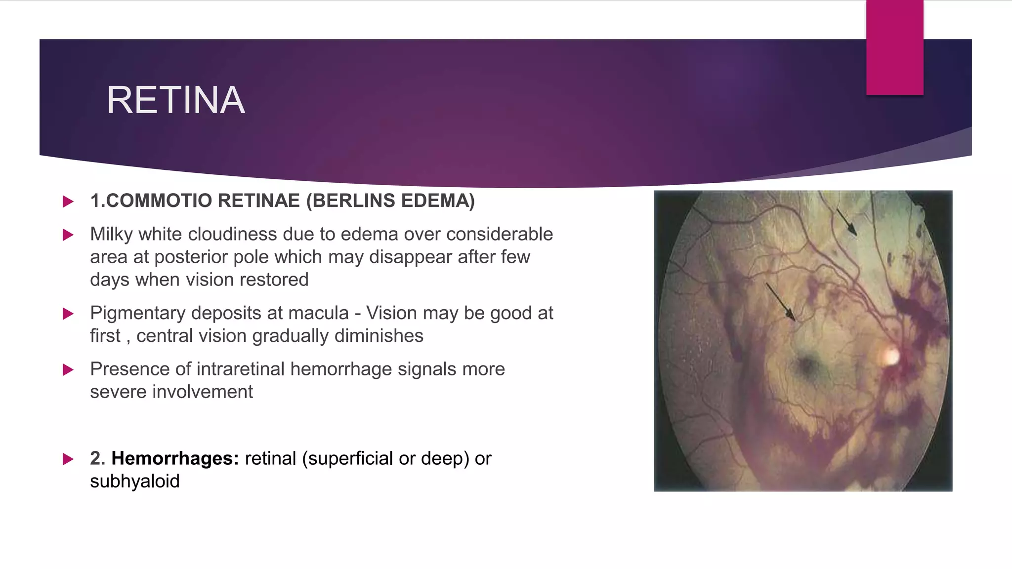 OCULAR TRAUMA - Classification of mechanical injuries, clinical ...